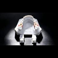 China Non Precious PFM Crown Implant Porcelain Fused To Metal Crown for sale