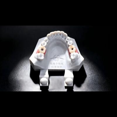 China Non Precious PFM Crown Implant Porcelain Fused To Metal Crown for sale