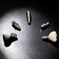 China Implant Porcelain Fused To Zirconia Implant Crown Bridge Highly Aesthetic for sale