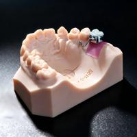 China Traction Appliance for Adjacent Teeth Prior to Implant Placement for sale