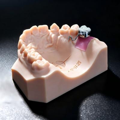 China Traction Appliance for Adjacent Teeth Prior to Implant Placement for sale
