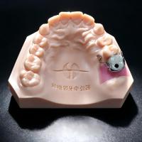 China Traction Appliance for Adjacent Teeth Prior to Implant Placement for sale