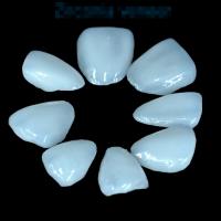 China EMAX Pressed Onlay Veneer High Accuracy Dental Veneer Excellent Fit for sale