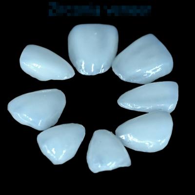 China EMAX Pressed Onlay Veneer High Accuracy Dental Veneer Excellent Fit for sale