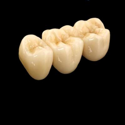 China White High Noble Precious Alloy Crown And Bridge Accurate And Custom for sale