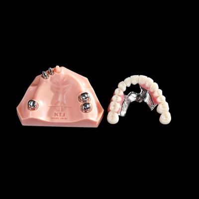 China Telescope Metal Crown And Bridge For Dental And Orthodontic for sale