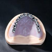 China ALL On  X Implant Titanium Bridge Dental Only Framework Professional for sale