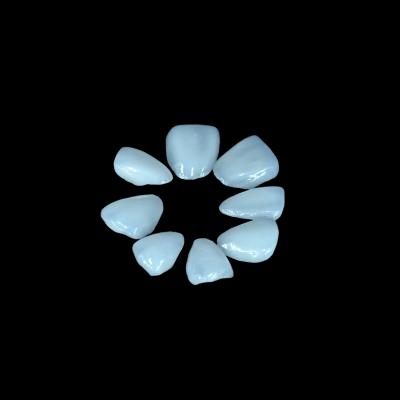 China High Esthetics Composite Crown Onlay Veneer Customizable Size for sale