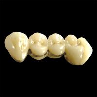 China Metallic / Natural Ti Base Crown Post Core Titanium Crowns For Teeth for sale