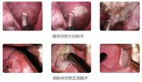 China Compact Cold Urology Coblation Plasma Surgery System Minimally Invasive 100W for sale