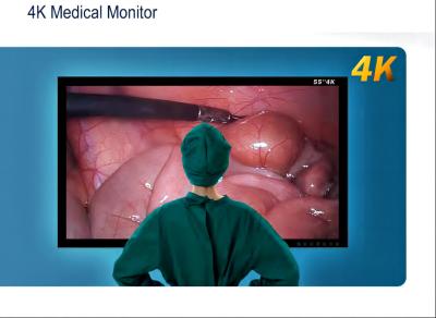 China 4K Surgical Endoscopy Camera 7 Inch Touch Screen with 5 Presets and C-Mount for sale
