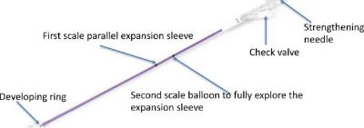China Kyphoplasty Vertebral Expansion Balloon Kit 14mm 4ml for Spinal Surgery for sale
