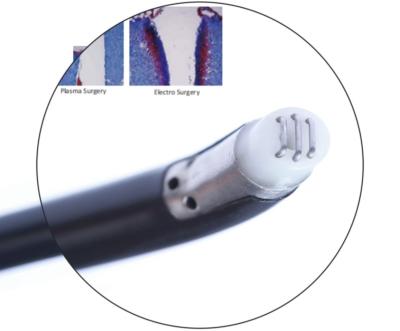 China Low Temperature Precise Surgical Ent Instruments Tonsillectomy Plasma Wand Radiofrequency Plasma Technology for High Standards for sale