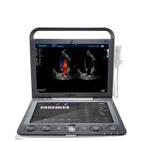 China Portable 3D 4D Color Doppler USG&Sonoscape S9 for sale