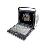 China Portable 3D 4D Color Doppler USG&Sonoscape S9 for sale