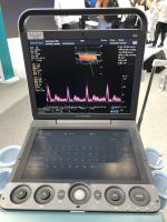 China Portable 3D 4D Color Doppler USG&Sonoscape S9 for sale