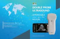 China MSL Highest Cost-effective Double Probes Wireless Color Doppler Ultrasound Scanner for sale