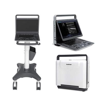 China MSK Ultrasound TDI CW Color Sonoscape E2 E3 & Sonoscape E1 Usg for sale