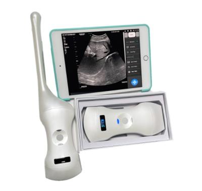 China 3 in 1 Wireless Convex Phased Array Linear Transvaginal Array  Color Doppler Ultrasound Scanner for sale