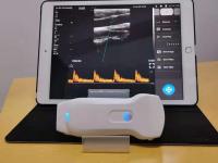 China Dual Portable Wireless Ultrasound Liner Probe 3 in 1 for sale