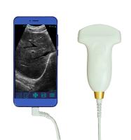 China Hot Sale Smart USB Convex Medical Doppler Ultrasound Scanner Ultrasound Probe for sale
