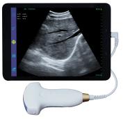China Hot Sale Smart USB Convex Medical Doppler Ultrasound Scanner Ultrasound Probe for sale