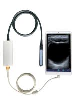 China Hot Sale Smart USB Convex Medical Doppler Ultrasound Scanner Ultrasound Probe for sale