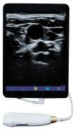 China Hot Sale Smart USB Convex Medical Doppler Ultrasound Scanner Ultrasound Probe for sale