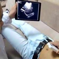 China Mini Wireless Ultrasound Machine Probe Wifi Ultrasound Probe for sale