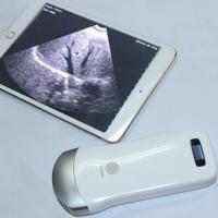 China Mini Wireless Ultrasound Machine Probe Wifi Ultrasound Probe for sale