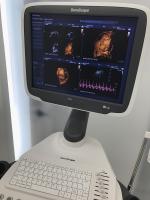 China Sonoscape S12 Maquina De Ultrasonido Ultrasound Portable Ecography Machine for sale