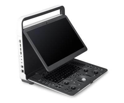 China Doppler Color Ultrasonic Ultrasonido Portatil SonoScape E2 for sale