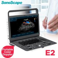 China Doppler Color Ultrasonic Ultrasonido Portatil SonoScape E2 for sale