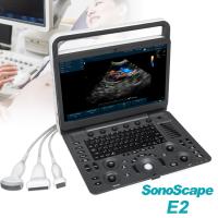 China Doppler Color Ultrasonic Ultrasonido Portatil SonoScape E2 for sale