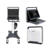 China Doppler Color Ultrasonic Ultrasonido Portatil SonoScape E2 for sale