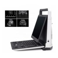 China SonoScape E2pro Color Doppler Echo Machine Ultrasound Machine USG with TDI CW PW Function for sale