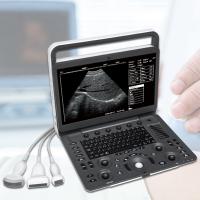 China High Quality Ultrasonic SonoScape E2 with Ultrasonic Sensors for sale