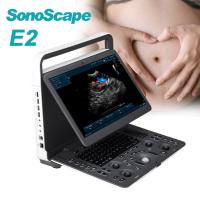 China High Quality Ultrasonic SonoScape E2 with Ultrasonic Sensors for sale