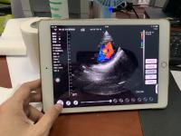 China Wifi Cardiac Transducer Portable Echocardiography Probe Medical Ultrasound Scanner Price for sale
