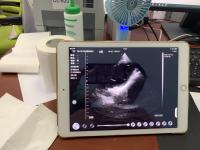 China Wireless Phased Array Ultrasound Transducer Handheld Cardiac Echography Wireless Ultrasound Probe Price for Sale for sale