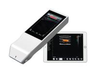 China Wireless Linear Array Ultrasound Probe Handheld Wifi Ultrasound Scanner Price for Sale for sale