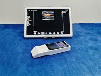 China Wireless Linear Array Ultrasound Probe Handheld Wifi Ultrasound Scanner Price for Sale for sale