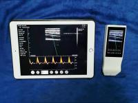 China Wireless Linear Probe High Frequency Probe Special Tool for Visual Puncture Guidance Integrated Handheld Ultrasound Scanner for sale