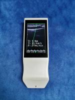 China Wireless Linear Probe High Frequency Probe Special Tool for Visual Puncture Guidance Integrated Handheld Ultrasound Scanner for sale