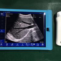 China High Quality Medical Ultrasound  Handheld Wireless Mini Color Doppler Ultrasound Scanner for sale