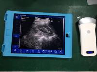 China High Quality Medical Ultrasound  Handheld Wireless Mini Color Doppler Ultrasound Scanner for sale