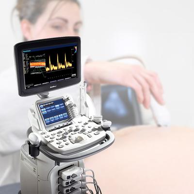 China S20 Sonoscape Ultrasound Sonoscape Ultrasound s2 Ultrasound Scanner Sonoscape for sale