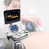 China S20 Sonoscape Ultrasound Sonoscape Ultrasound s2 Ultrasound Scanner Sonoscape for sale