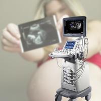 China S20 Sonoscape Ultrasound Sonoscape Ultrasound s2 Ultrasound Scanner Sonoscape for sale