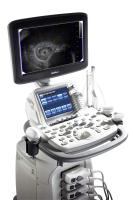 China S20 Sonoscape Ultrasound Sonoscape Ultrasound s2 Ultrasound Scanner Sonoscape for sale